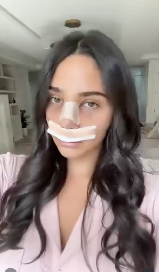 RHONJ Melissa Gorgas Daughter Antonia Gets Backlash After Nose Job